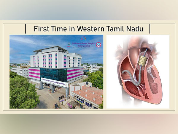 Sri Ramakrishna Hospital introduces groundbreaking TPVR procedure ...